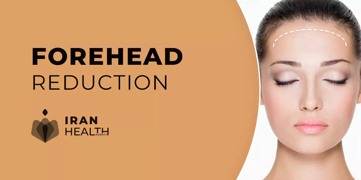 Forehead Reduction Surgery | Hairline Lowering Affordable Cost And Best ...
