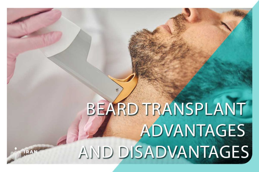 Beard Transplant Advantages And Disadvantages