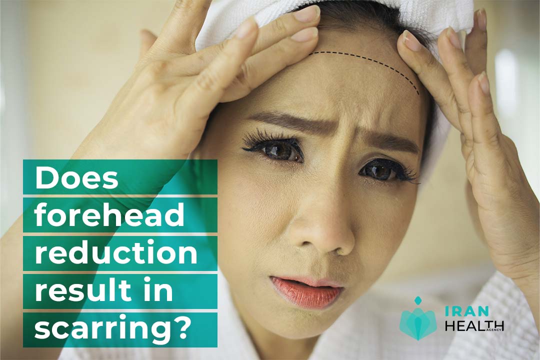 Forehead Reduction Surgery | Hairline Lowering Affordable Cost And Best ...