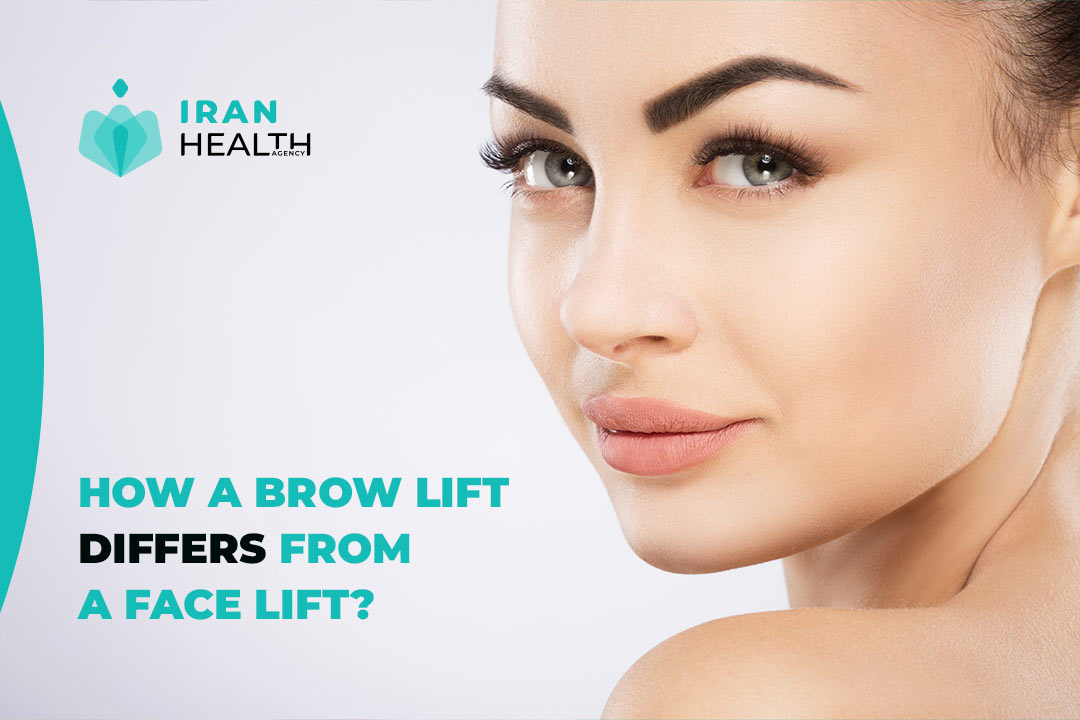 Brow Lift In Iran | Best Forehead Lift Surgery In Iran