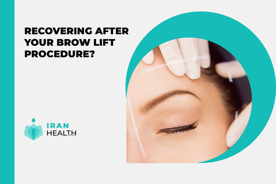 Brow Lift In Iran | Best Forehead Lift Surgery In Iran