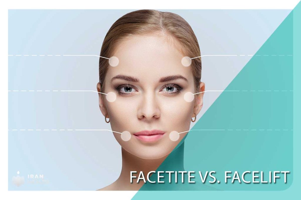 FaceTite Vs. Facelift: Which One Gives Better Results? | Iran Health Agency