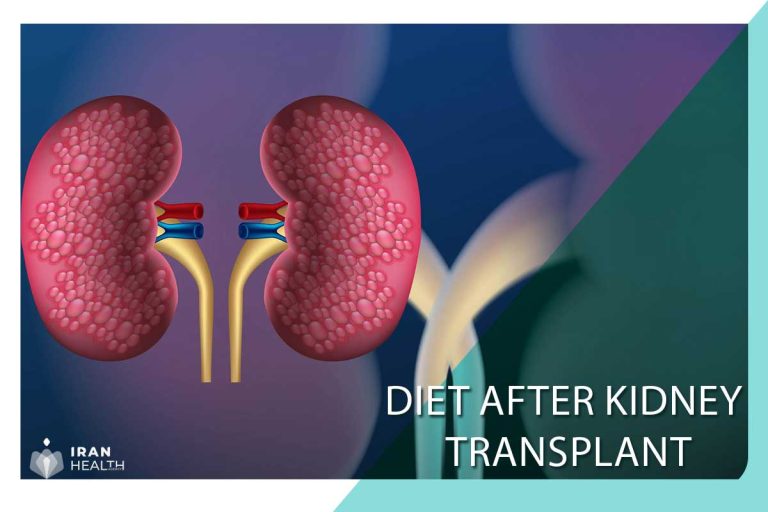 Diet After Kidney Transplant (patient Guide) [with Kidney Recipe Finder ...