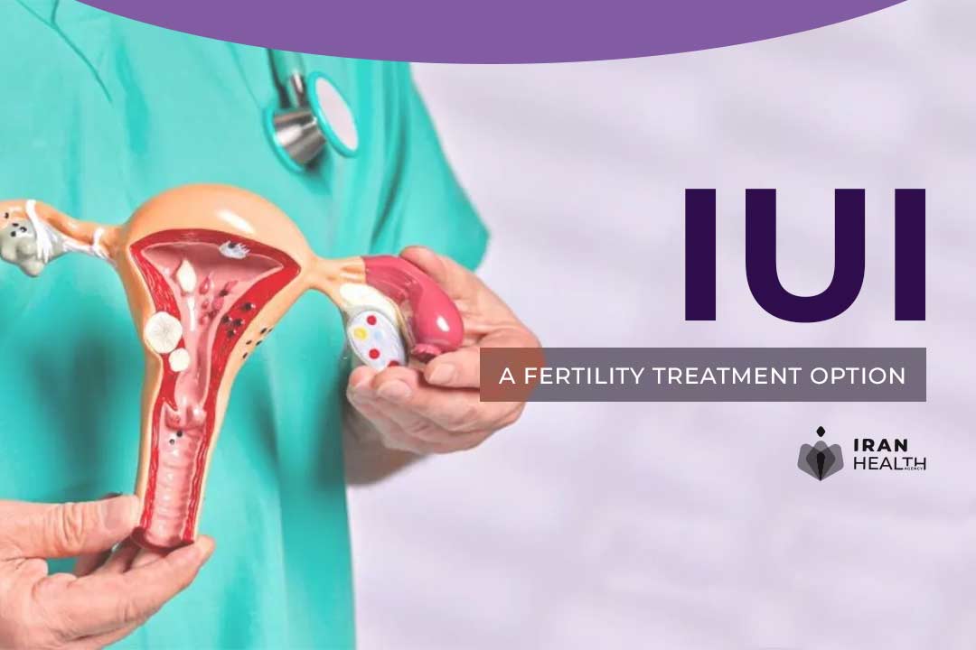 Intrauterine Insemination In Iran | Best Success Rates & Clinics