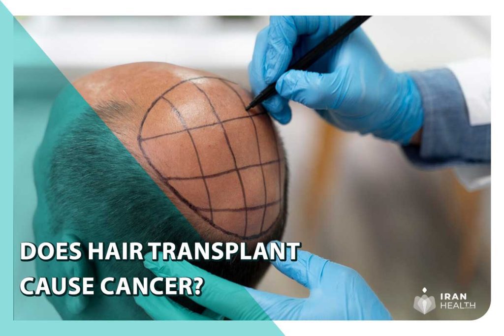 Does Hair Transplant Cause Cancer? | Iran Health Agency
